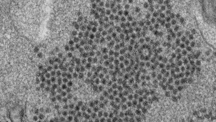 Study points to virus as culprit in kids' polio-like illness | 9news.com