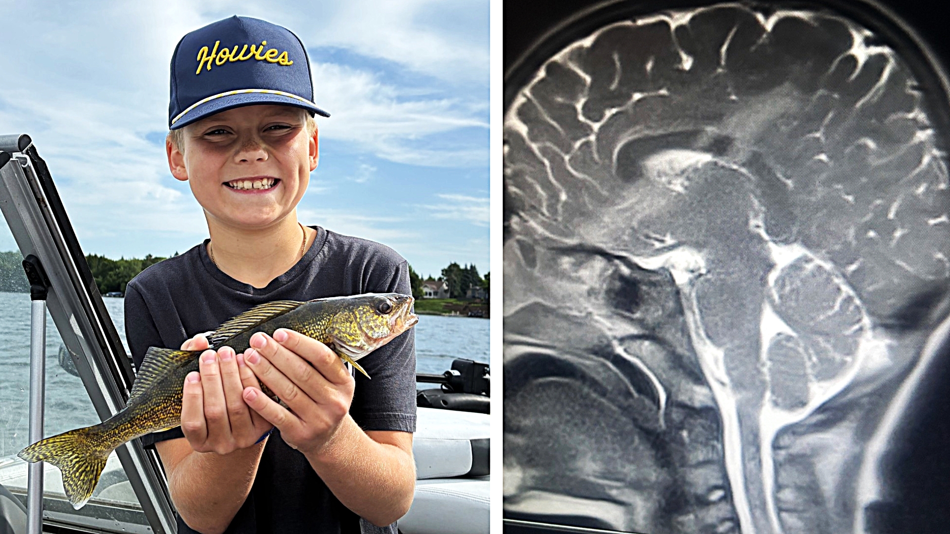 9-year-old MN boy survives arrow through his brain | 9news.com