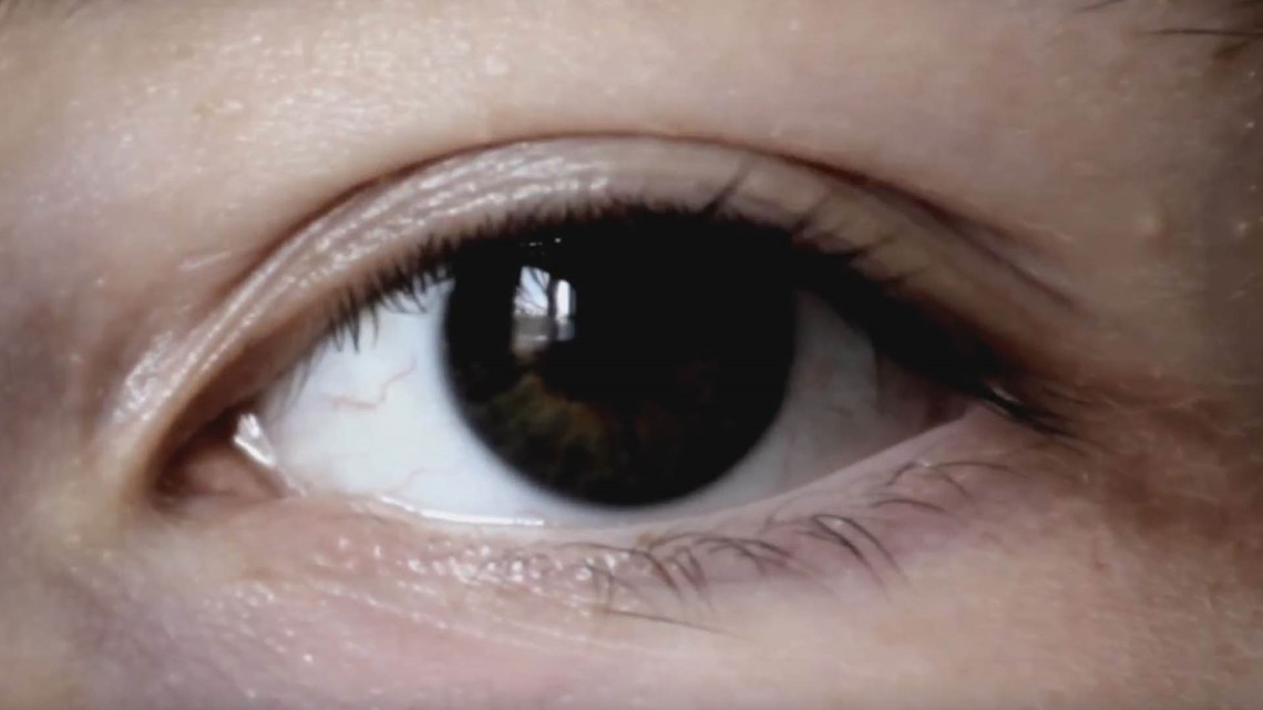 Here's how fast your retina could burn looking at eclipse unprotected ...