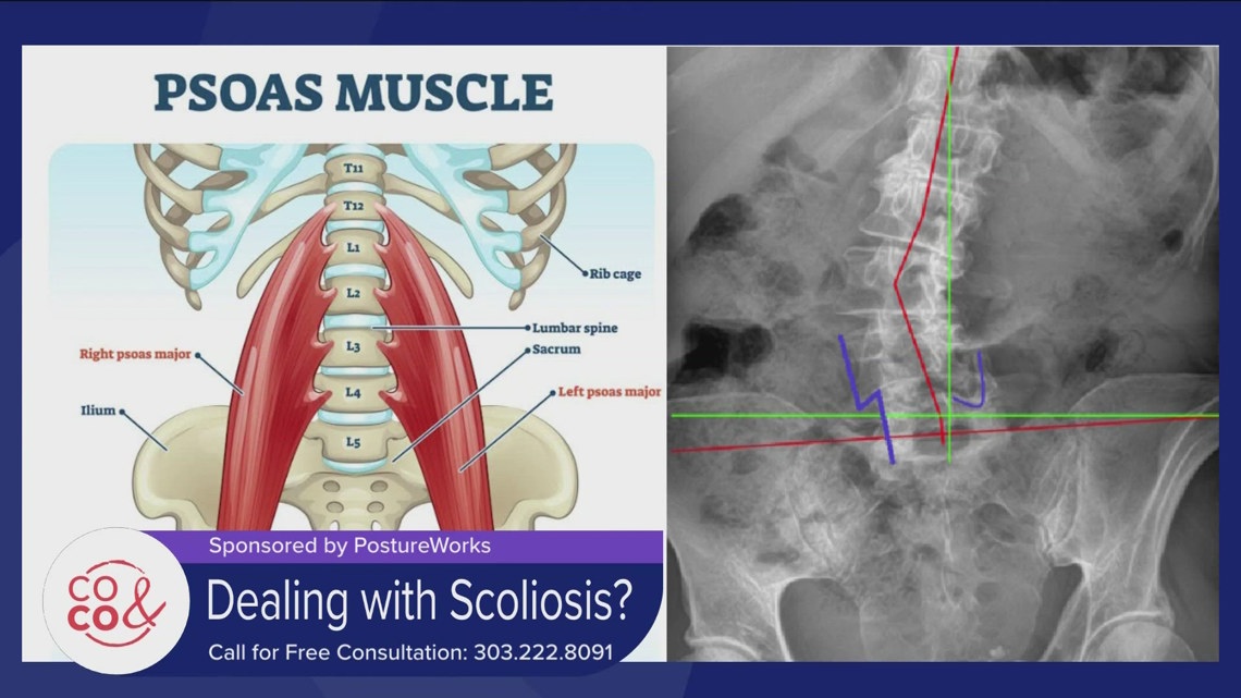 Put Back Pain Behind You with Help from PostureWorks | 9news.com