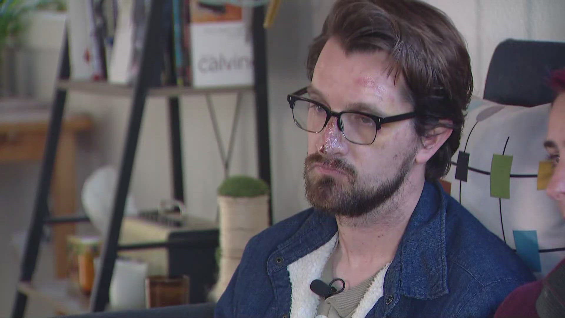 Aurora teacher says he was injured in hit-and-run while biking | 9news.com