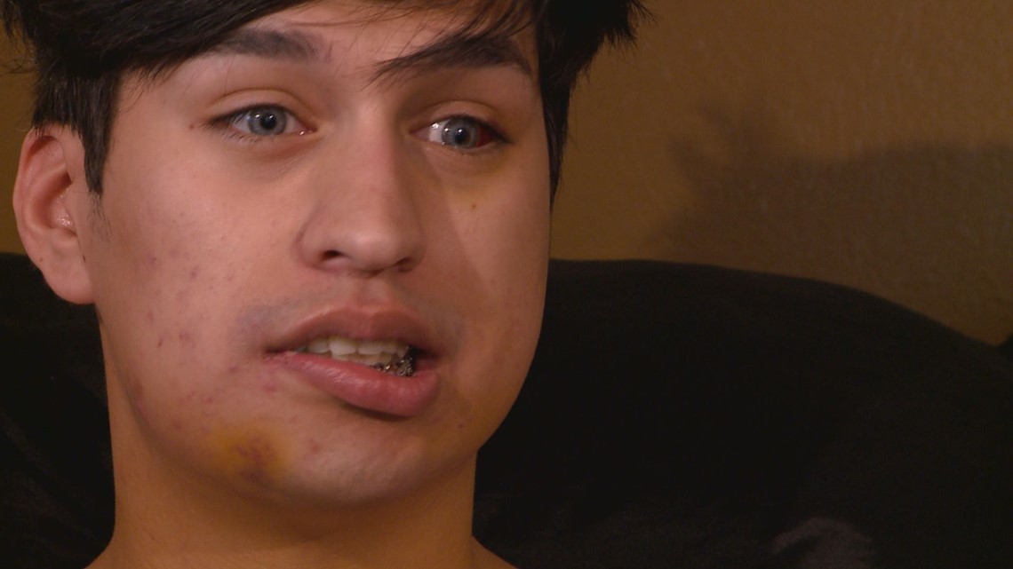 Denver police investigating assault on transgender woman downtown ...