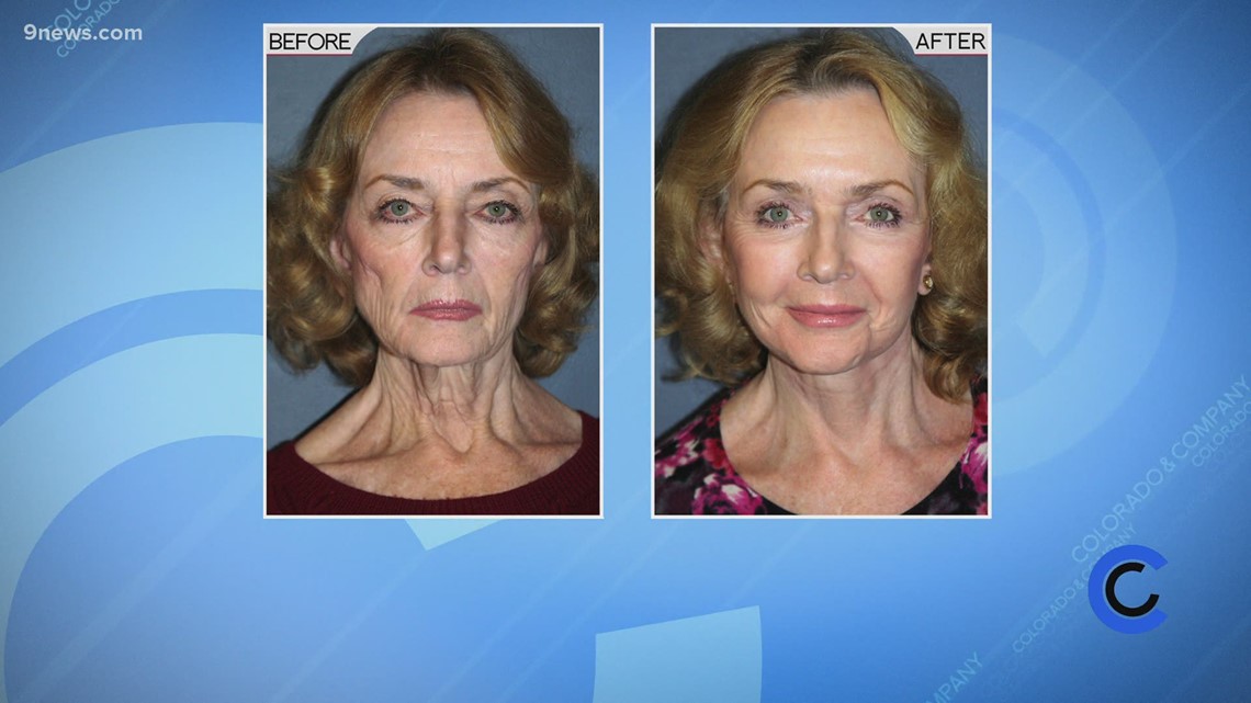 Smith Cosmetic Surgery - December 24, 2020 | 9news.com