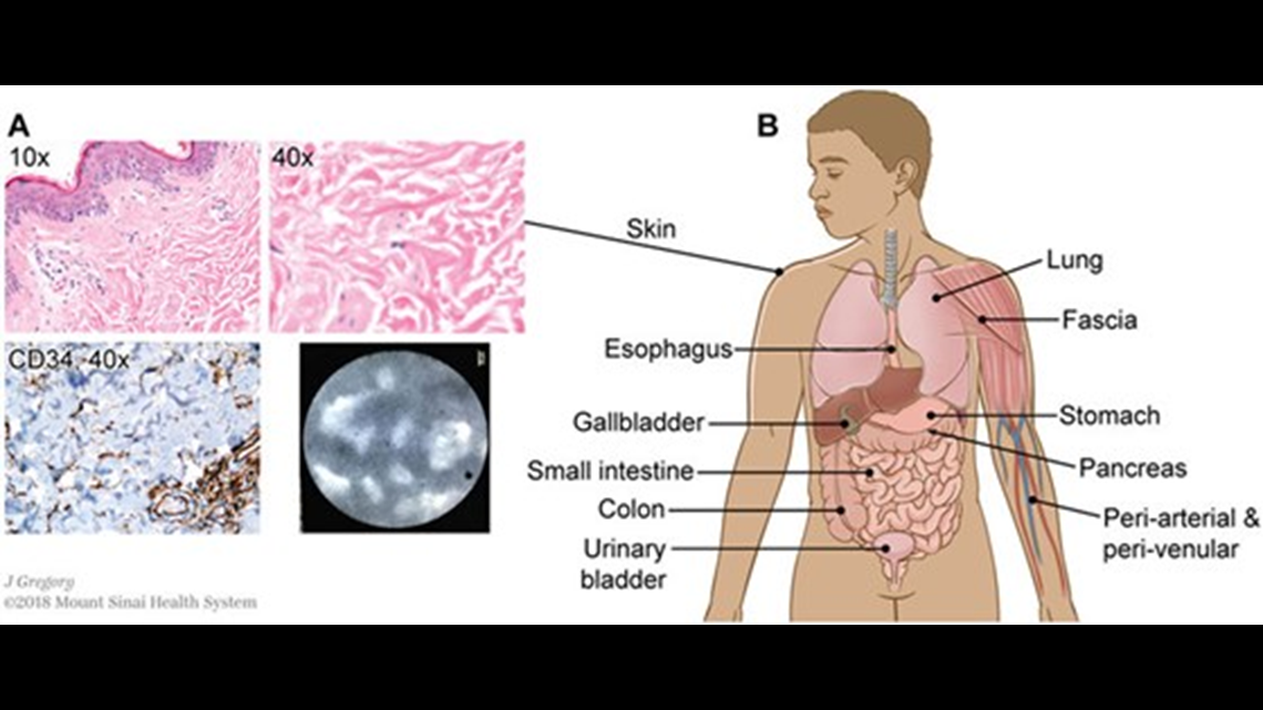 Let's learn more about that 'new' organ just discovered | 9news.com