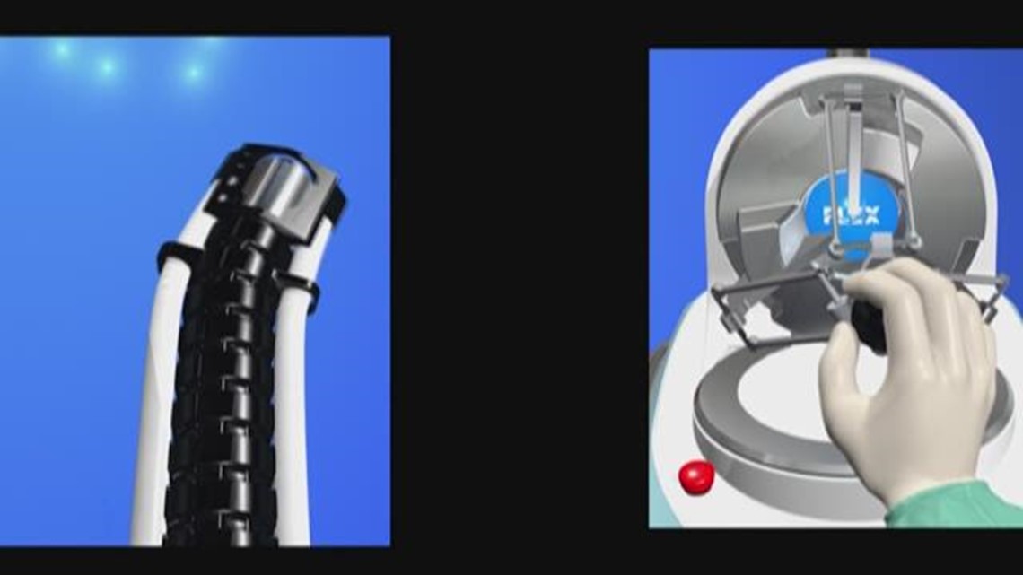 Robotic technology used for Colorectal cancer treatment | 9news.com