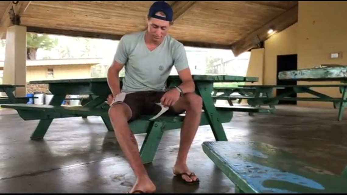 Colorado man who lived through a bear attack was just bitten by a shark ...