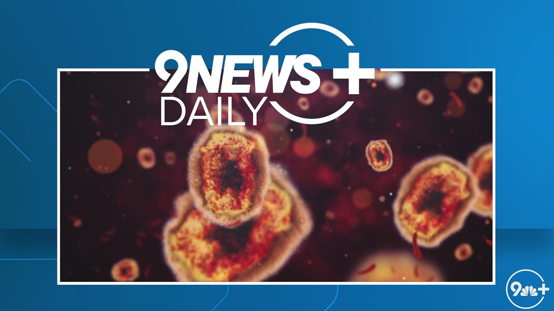 How does monkeypox spread and what are the symptoms? | 9news.com