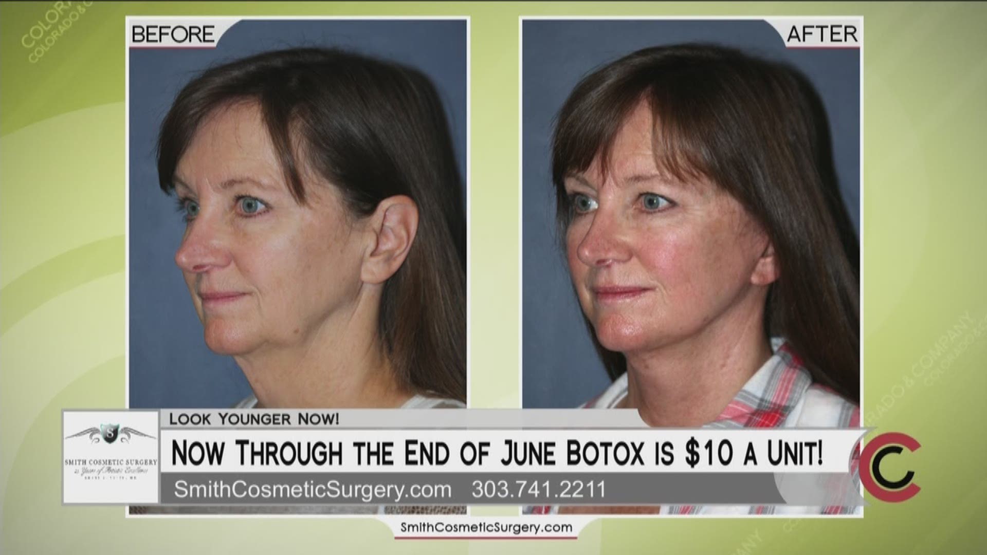 Smith Cosmetic Surgery - June 25, 2019 | 9news.com