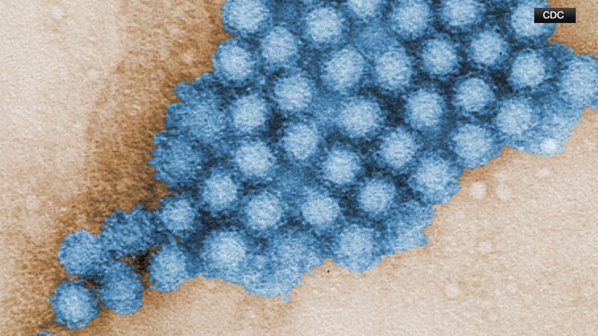 Stomach bug causing sudden vomiting, diarrhea surges in US | 9news.com