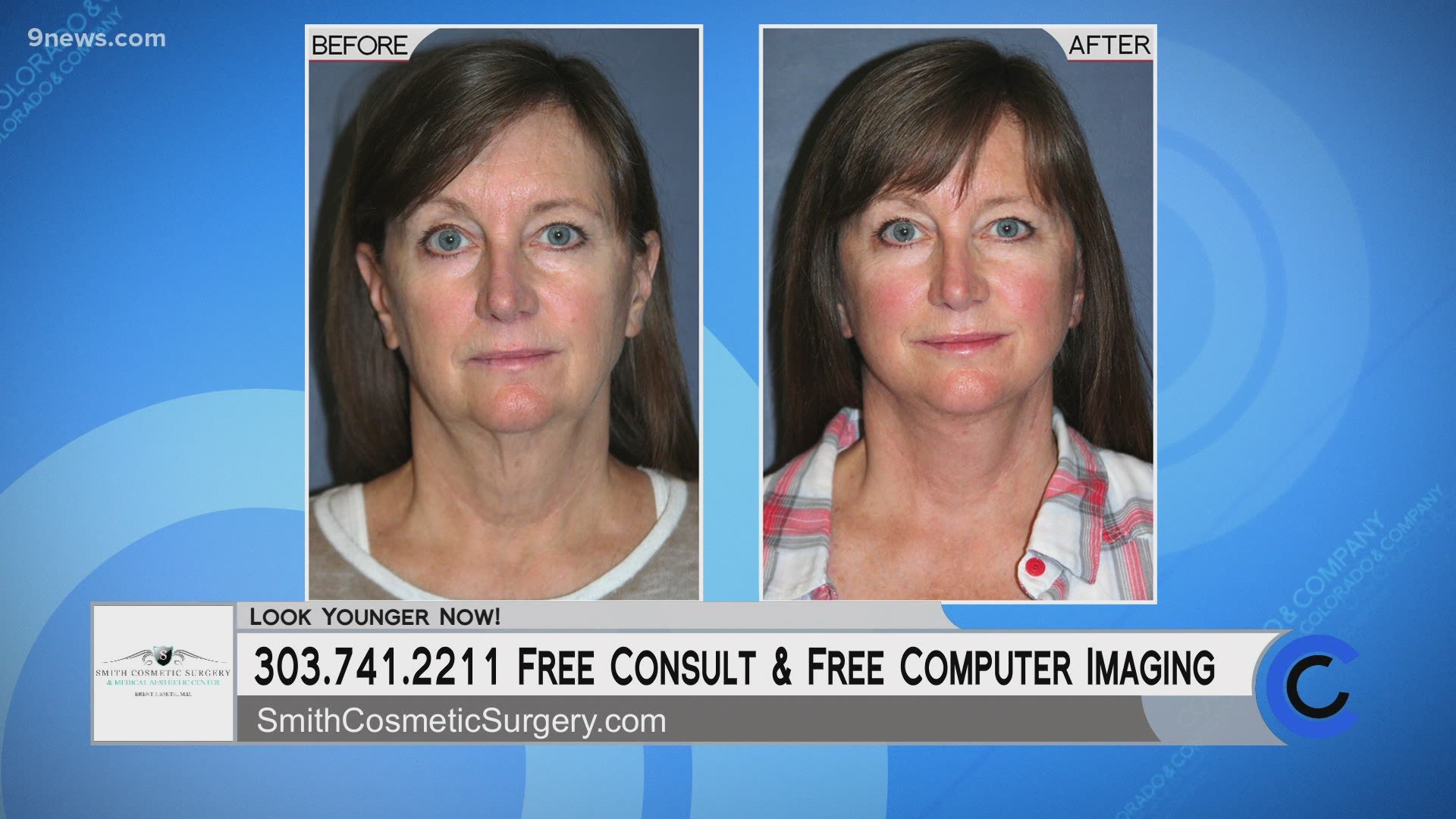 Smith Cosmetic Surgery - October 13, 2020 | 9news.com