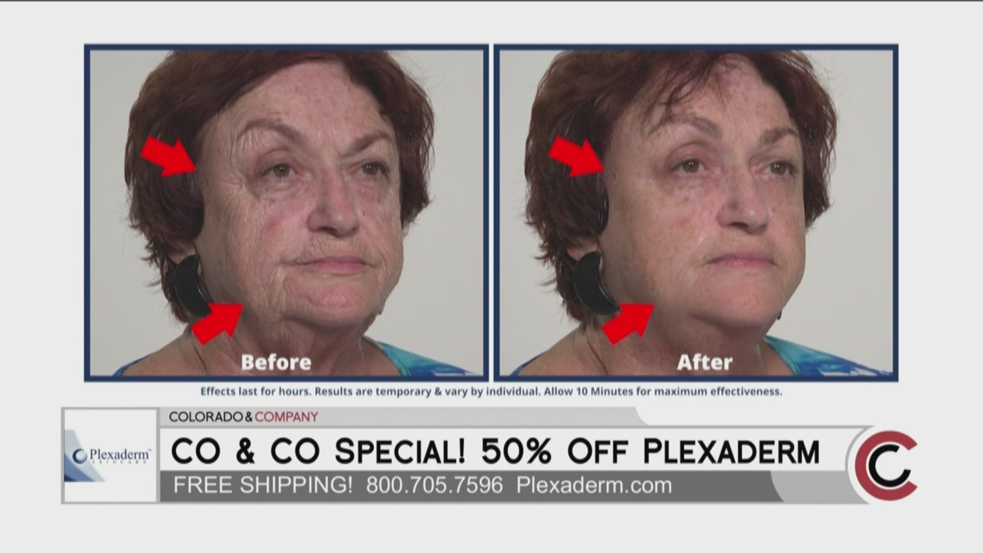 Plexaderm - February 26, 2020 | 9news.com