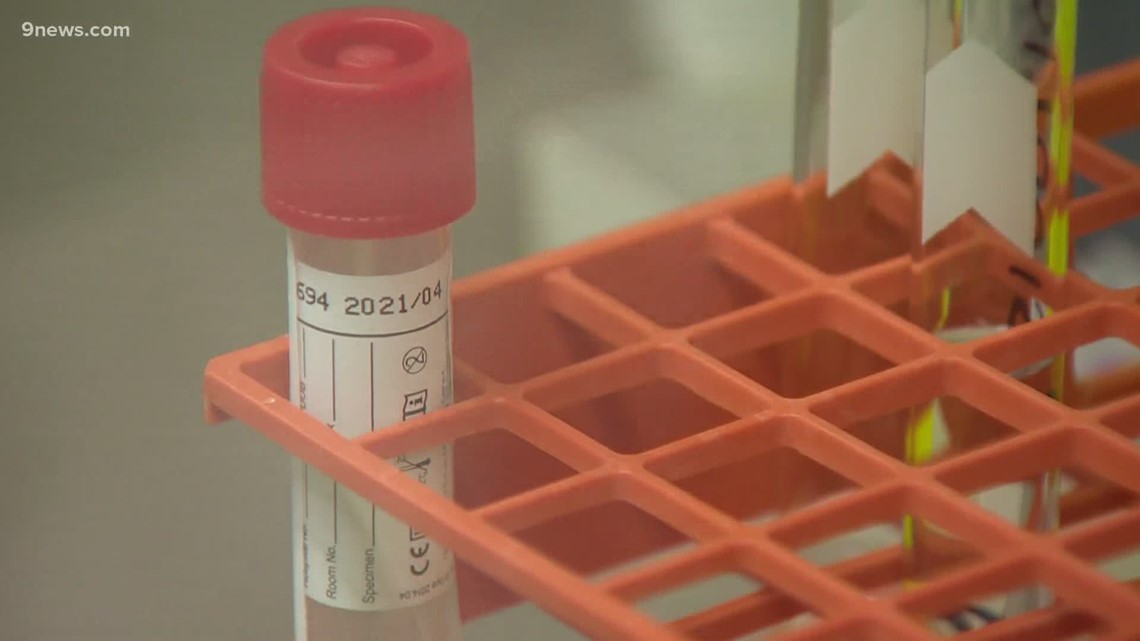 Companies advertising COVID-19 testing get 'cease and desist' | 9news.com
