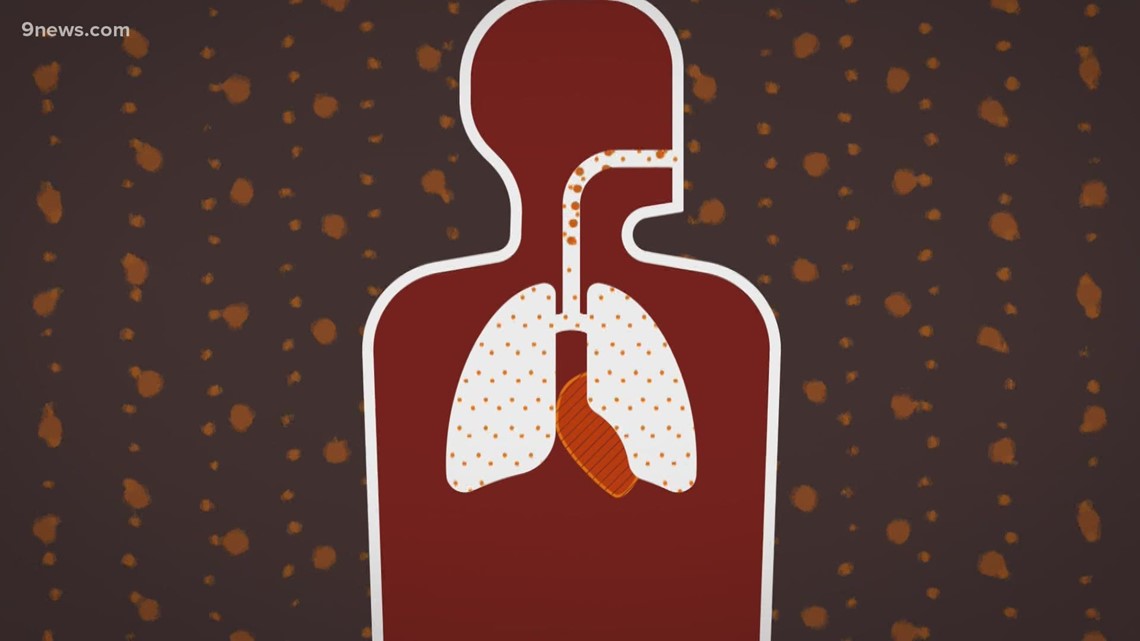 How particles of wildfire smoke can affect our health | 9news.com