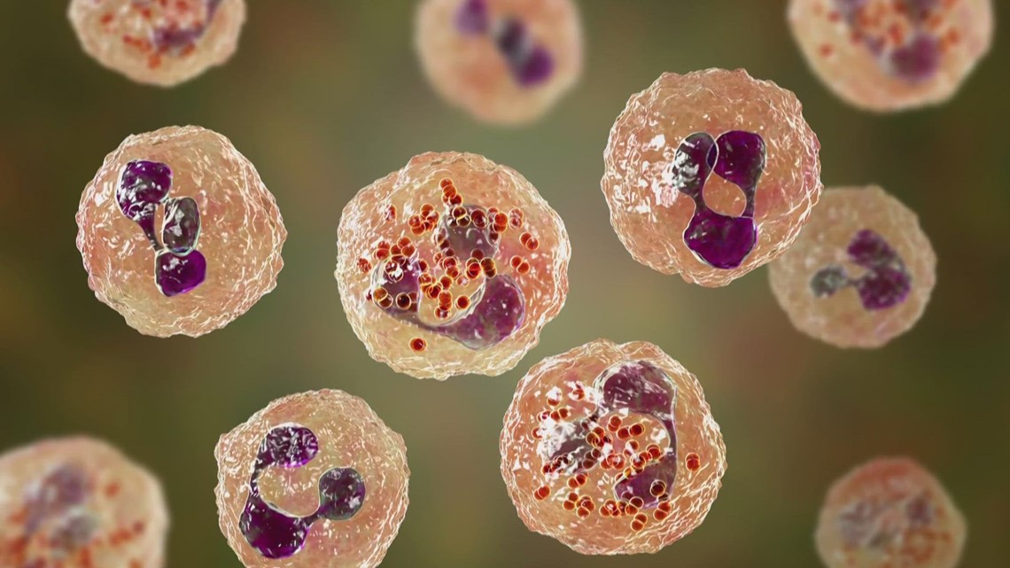 4 cases of meningococcal bacteria identified among people experiencing ...