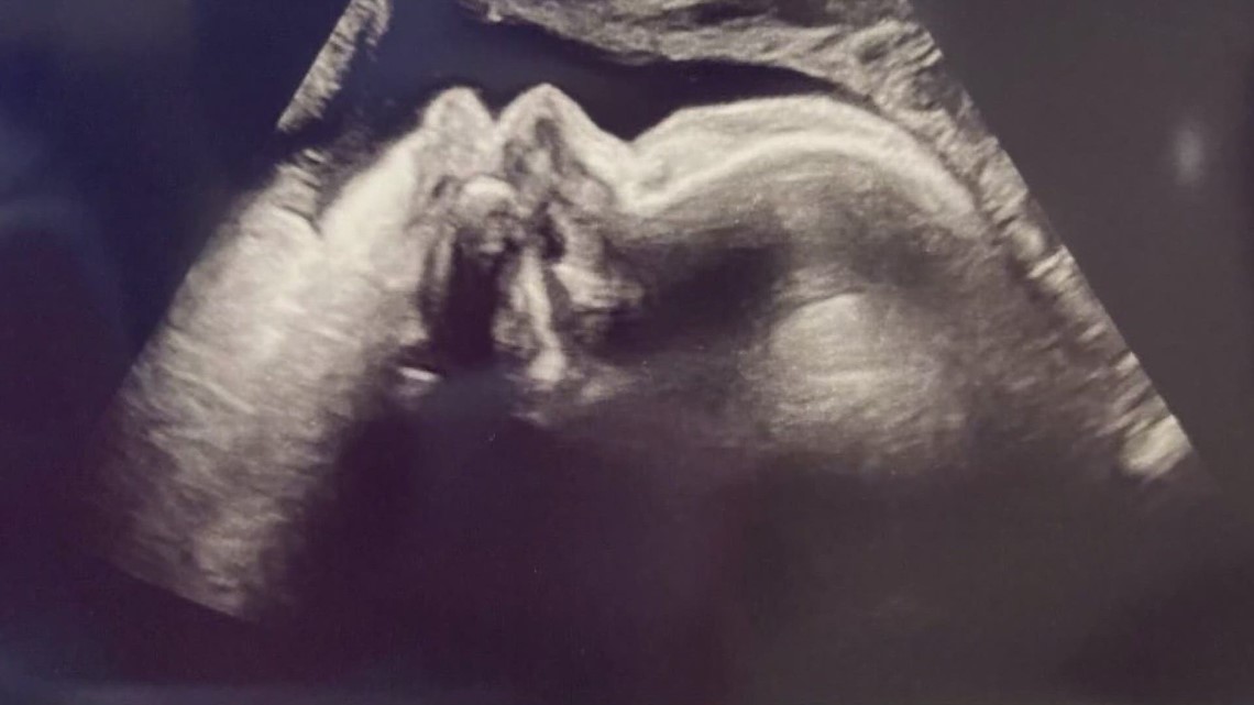 Snow babies! Expecting moms prepare to deliver in a snowstorm | 9news.com