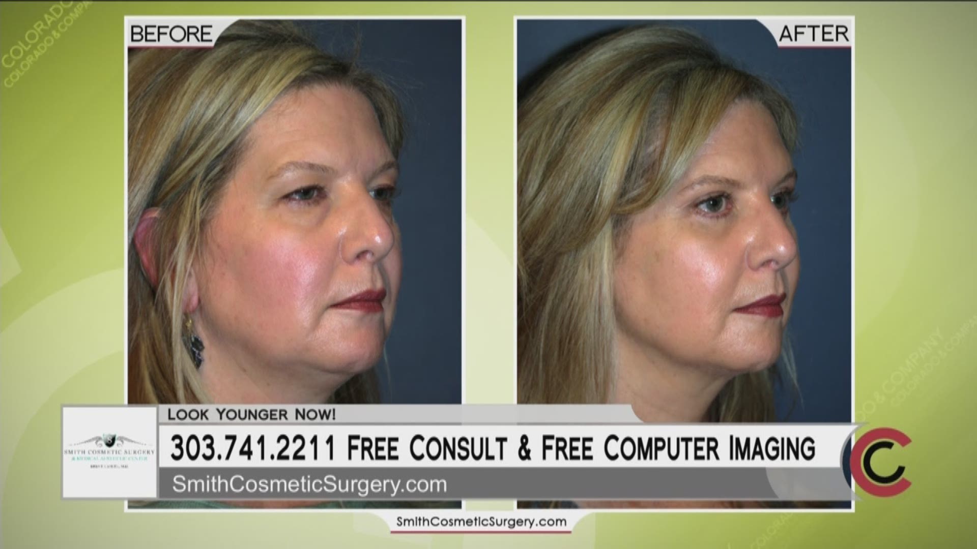 Smith Cosmetic Surgery - August 6, 2019 | 9news.com