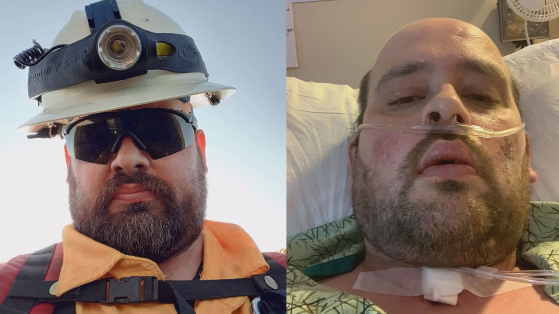 Firefighter got COVID at Colorado fire, spent weeks on ventilator ...