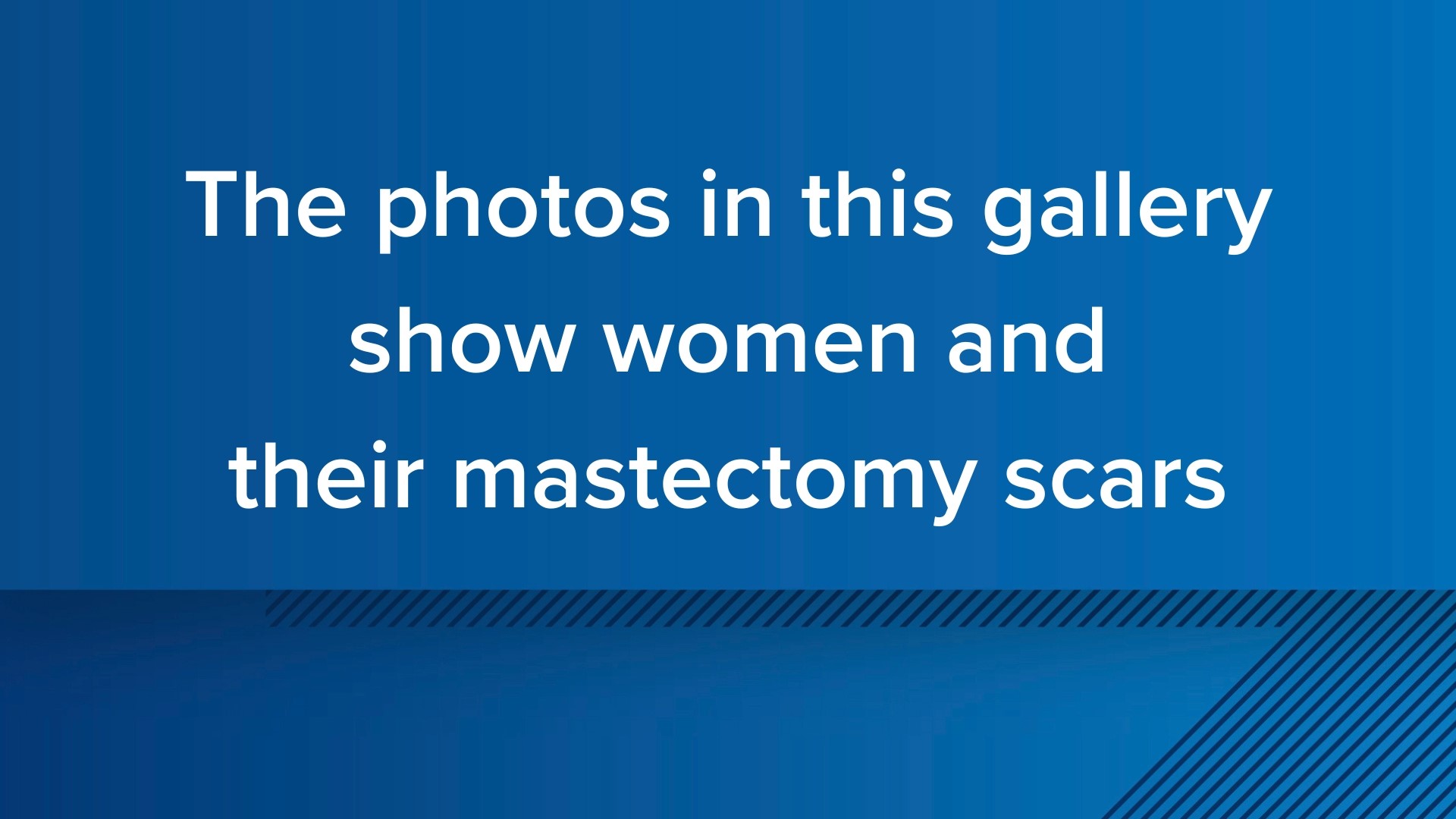 Breast cancer survivors show their scars to erase stigma | 9news.com