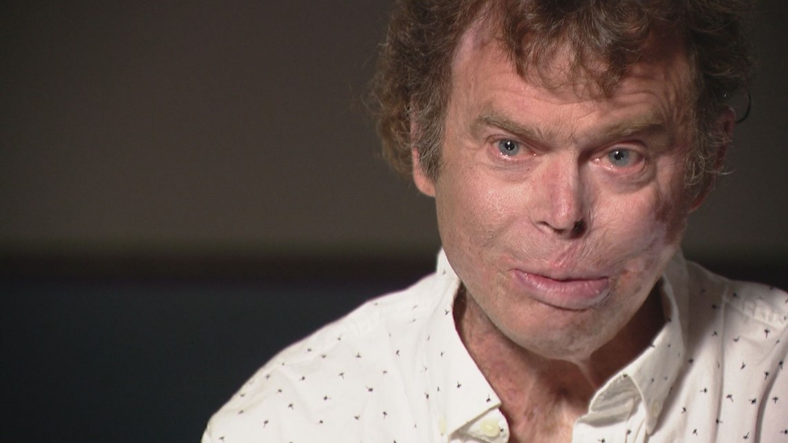 Dave Repsher reacts to move to replace Airbus fuel systems | 9news.com