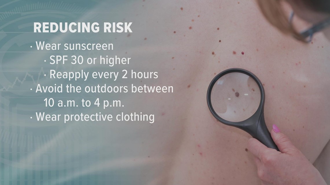 Common skin cancers and how to protect yourself | 9news.com