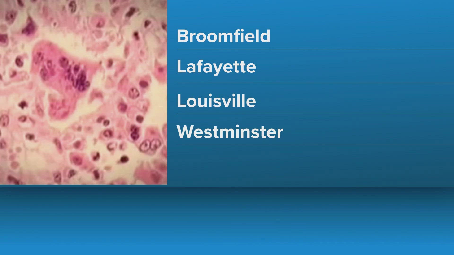 Health officials warn public after measles case in Broomfield | 9news.com