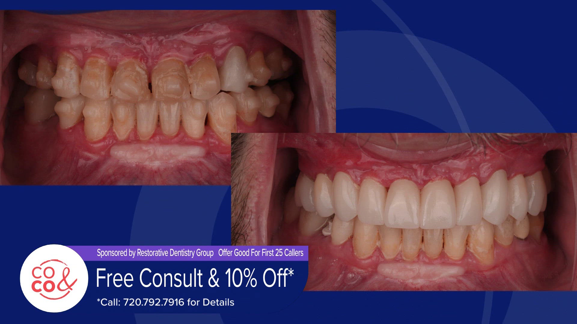You'll Have a Reason to Smile at Restorative Dentistry Group | 9news.com