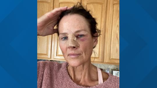 Kathy Sabine returns to 9NEWS after cancer diagnosis, surgery | 9news.com