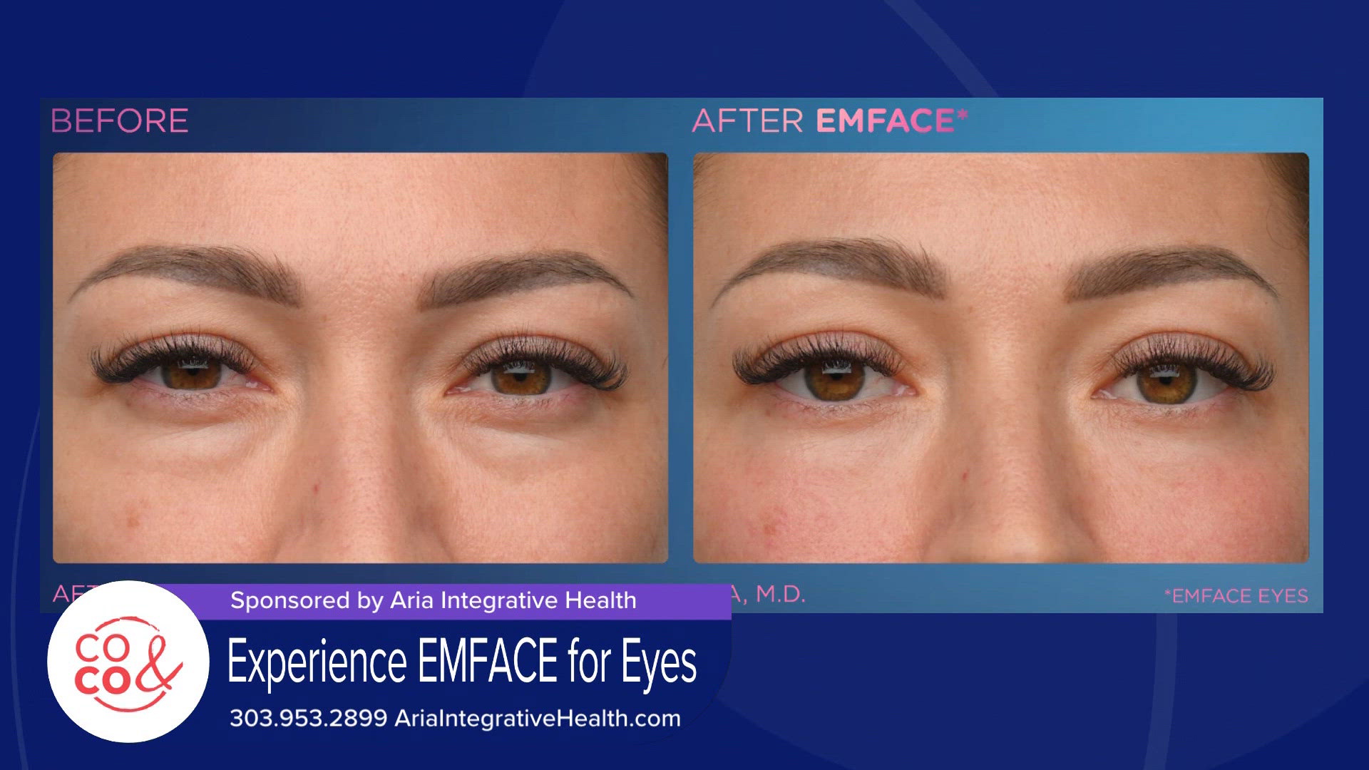 Feel and Look Refreshed with Treatments from Aria Integrative Health ...