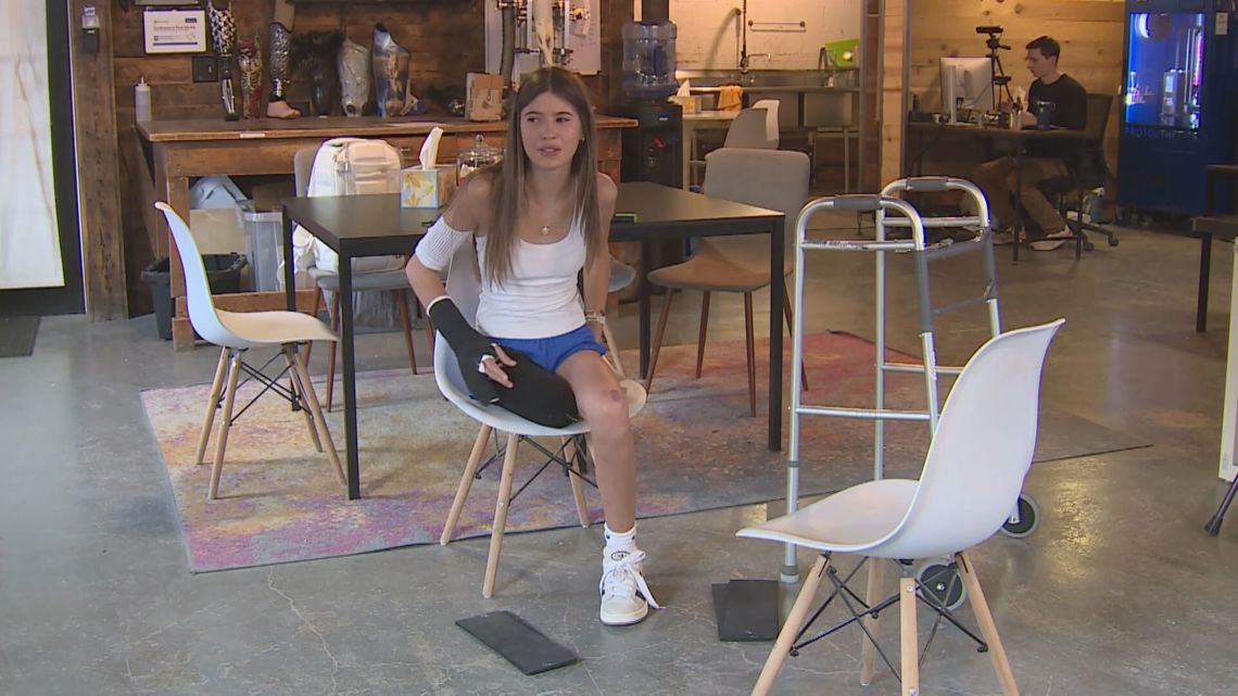 Colorado teen recovering after losing leg in shark attack | 9news.com