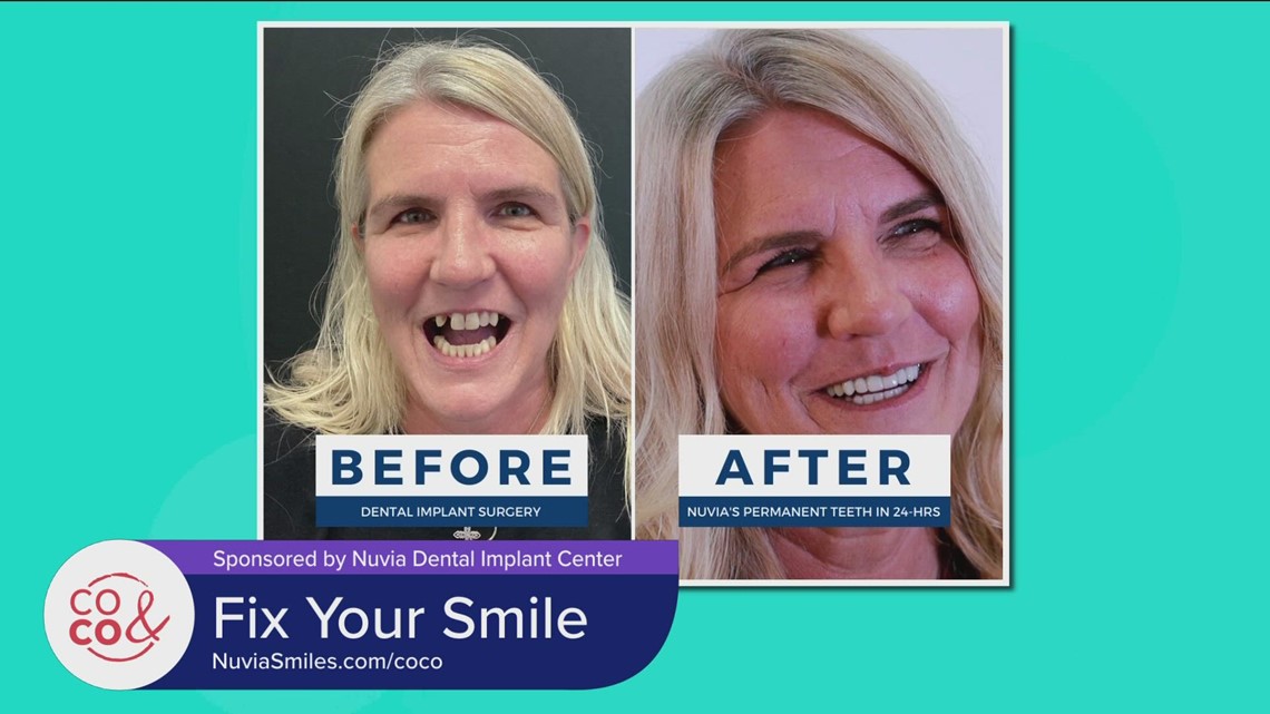 Nuvia Dental Implant Center - October 26, 2022 | 9news.com