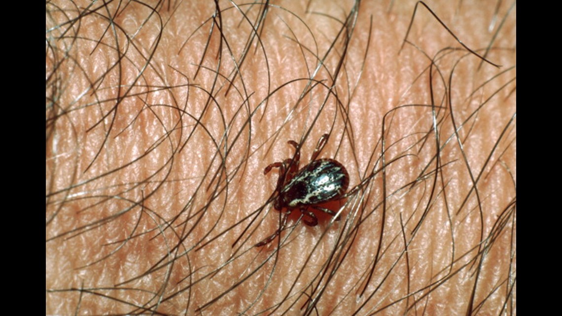 Should I burn a tick off? 5 common myths about ticks | 9news.com