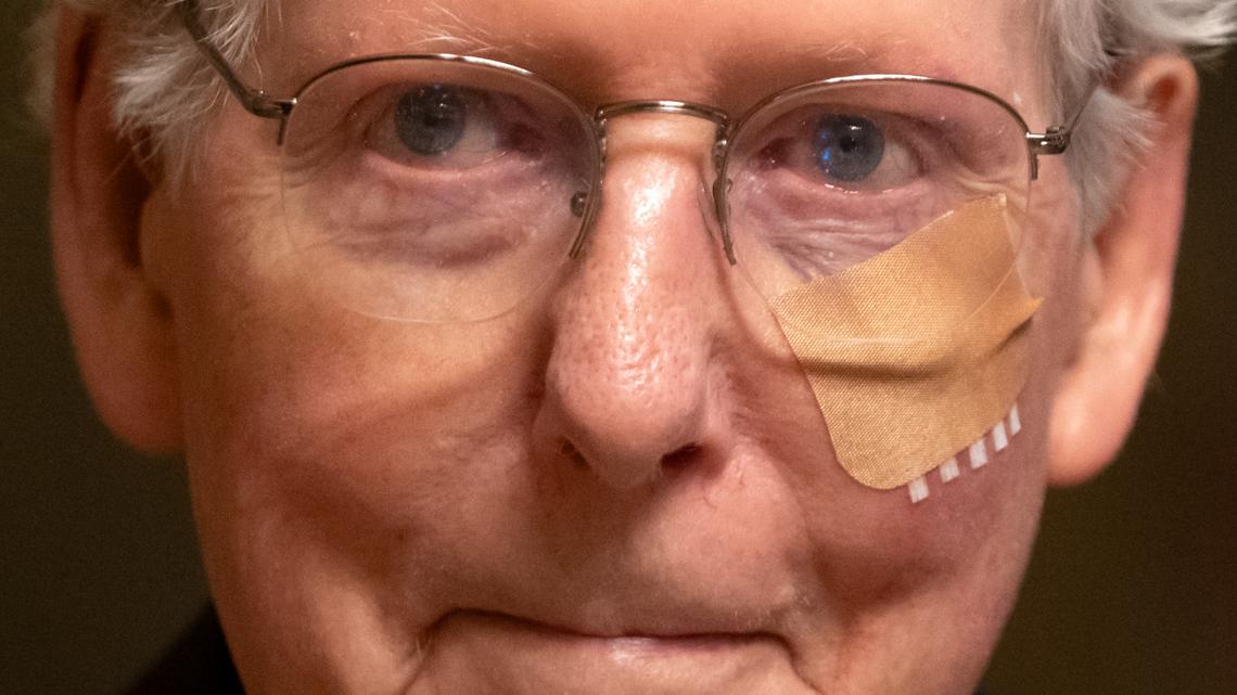 McConnell absent from Senate as he recovers from recent fall | 9news.com