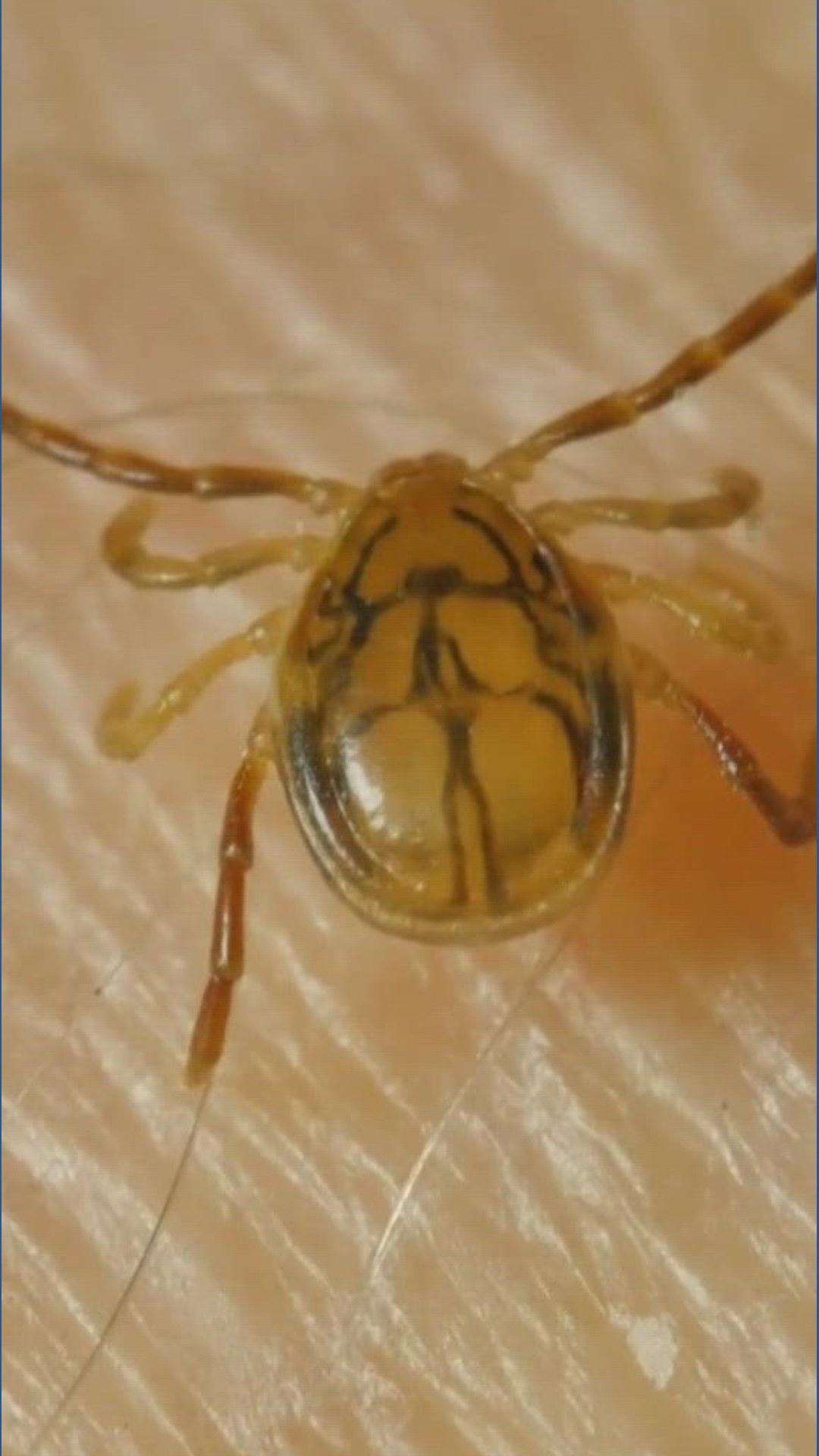 Emergency room visits for tick bites are at the highest weekly rates in ...